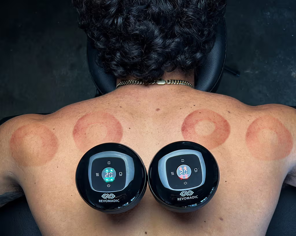 REVO™ Smart Cupping Therapy Massager – Revomadic